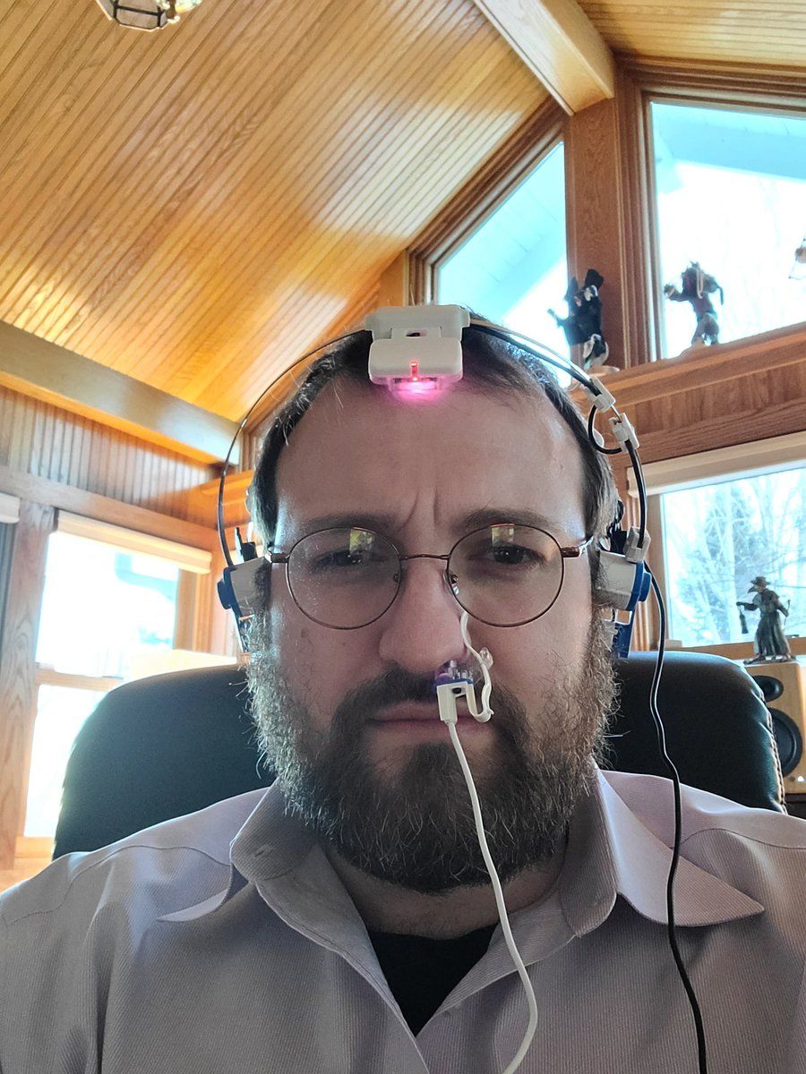 Cardano Creator Charles Hoskinson's Heroic Kitten Rescue Takes a ...